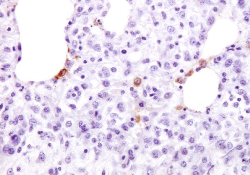 Porcine reproductive and respiratory syndrome virus | Virus | The ...